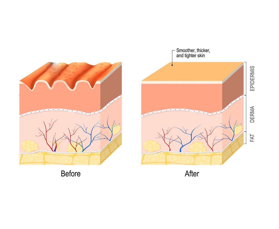 StretcHeal – #1 Trusted Best Stretch Mark Cream
